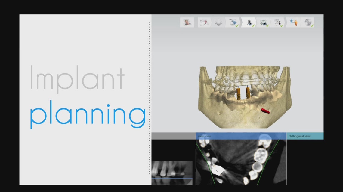 Dentists at UB using artificial intelligence to repair teeth – Europeantech Dentists at UB using artificial intelligence to repair teeth – Europeantech