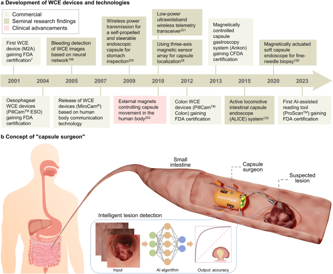 Robotic wireless capsule endoscopy: recent advances and upcoming ...