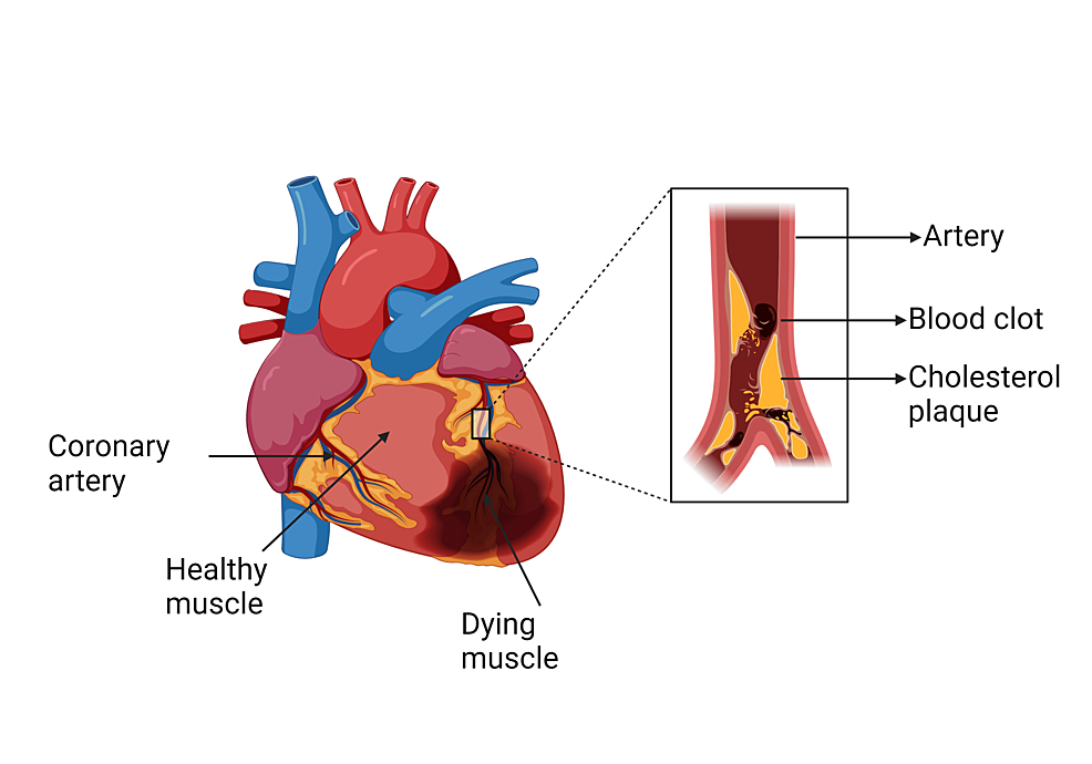 Advancements in Artificial Intelligence for Precision Diagnosis and ...