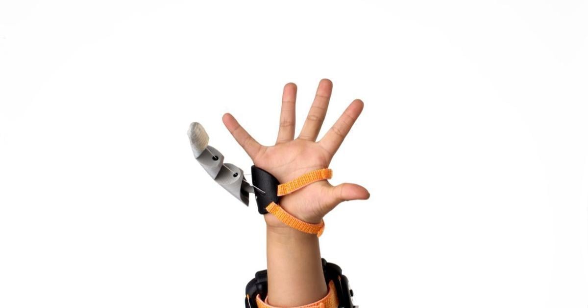 Cambridge Scientists Devise Robotic Extra 'Third Thumb' You Can Work As ...