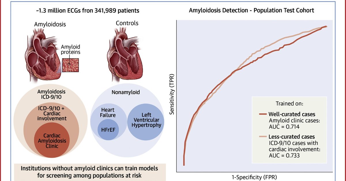 Using ECG AI to find the cardiac amyloidosis needles in the haystack ...